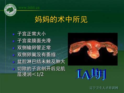 子宫内膜癌 中国医科大学附属盛京医院 栾南南 ppt download