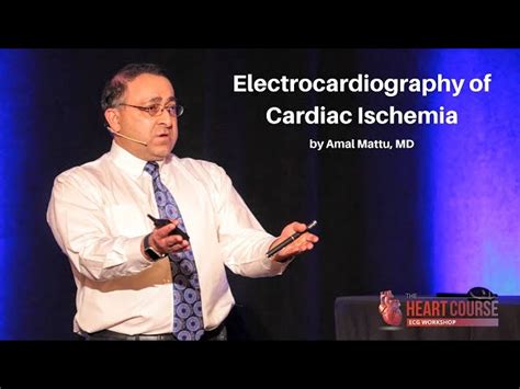 Free Video Electrocardiography Of Cardiac Ischemia The Heart Course