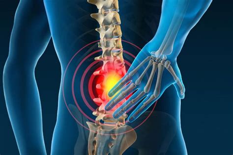 Qué Es La Lumbalgia Y Cómo Actuar Si Te Quedas Clavado Fisioterapia Derio