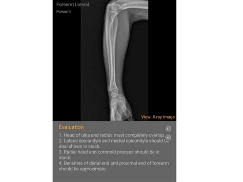 Presentation Upper Limb Pptx It Is About X Ray Positioning Of Upper