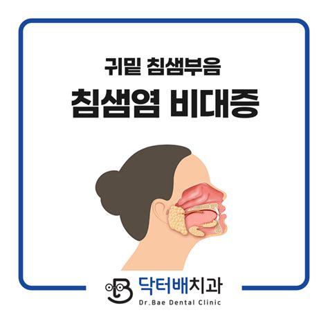 귀밑 침샘부음 침샘염 증상 비대증일까 네이버 블로그