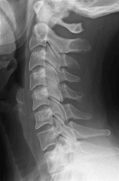 Test Yourself Regular Sets Set 7 Emergency Department Radiology Courses