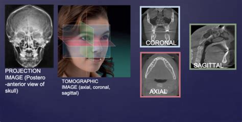 Radio Ct Cbct Techniques And Applications Advanced Imaging