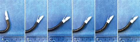 Linear Endobronchial Ultrasound Thoracic Key