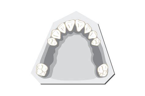 Classe 3 De Kennedy Braincp