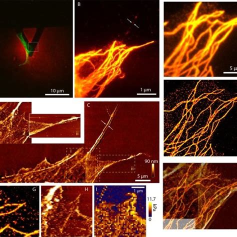 3d Sted And Confocal Imaging Sted Confocal Histogram From Microtubule