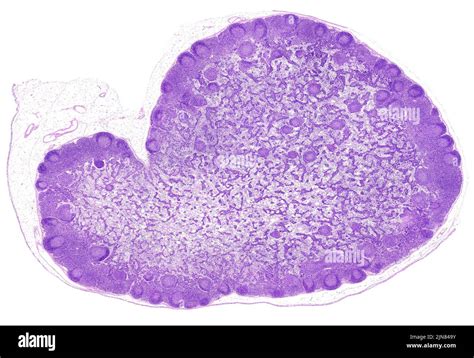 Lymph Node Light Micrograph Stock Photo Alamy