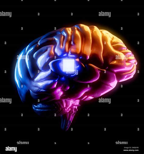 Link Neuralink New Artificial Intelligence Technology That Allows You