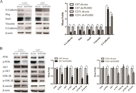 Plod2 Regulates The Expression Of Emt Associated Genes In Glioma Cells
