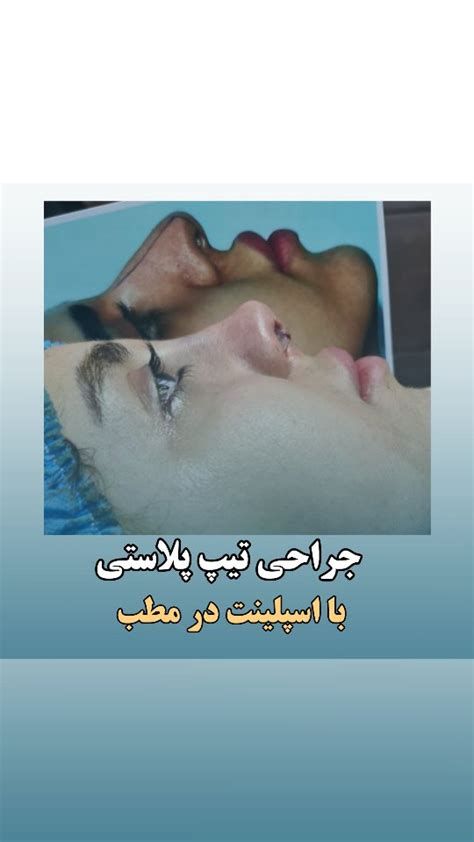 ‎جراح بینی و زیبایی کرمانشاه دکتر نادرنظری‎ ‎ جراحی تیپ پلاستی با
