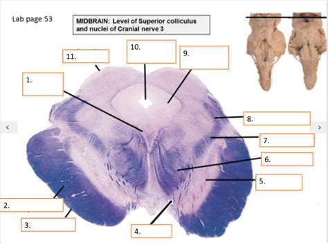 Neuroanatomy Midbrain Level Of Superior Colliculus And Nuclei Of Cn Iii