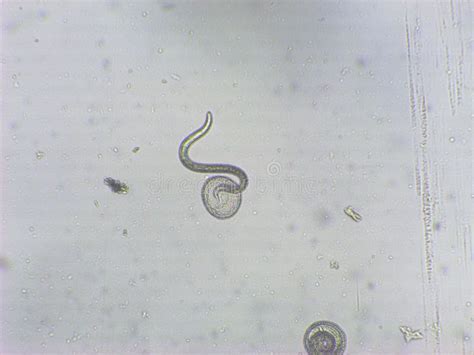 Toxocara Canis Second Stage Larvae Hatch From Eggs Stock Image Image