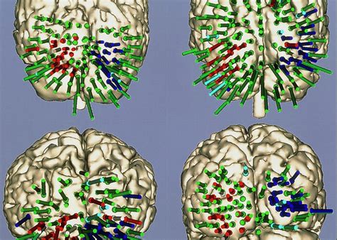 Functional Map Of The Brains Visual Cortex Areas Greeting Card By Science Photo Library