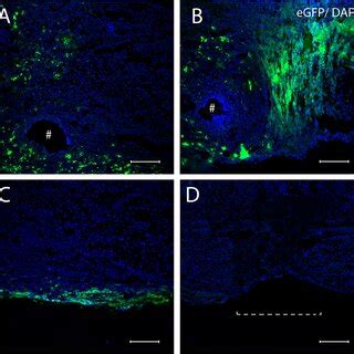 Longitudinal Sections Of Rat Sciatic Nerve Intact Nerve N Nuclei Of Download Scientific