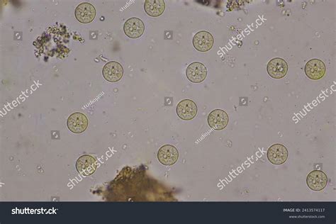 Entamoeba Coli Protozoa Cyst Stage Stools Stock Photo 2413574117