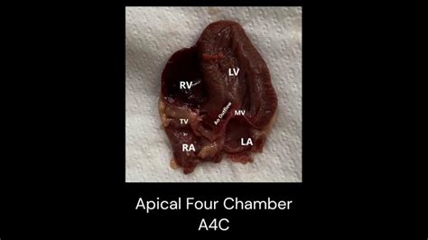 Tte Views On A Chicken Heart Jade Wollschlaeger Mms Pa C