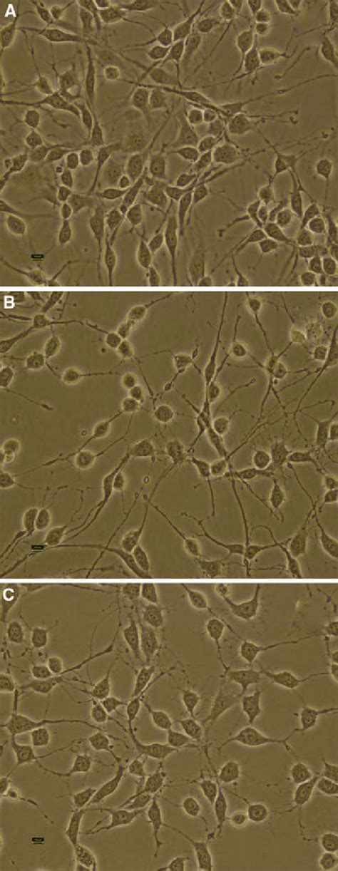 Effects Of Fs 0311 On Pc12 Cell Injury Induced By Ab 25 35 A Control