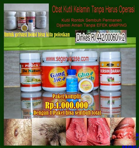 Contoh Gambar Penyakit Kutil Kelamin Pada Wanita