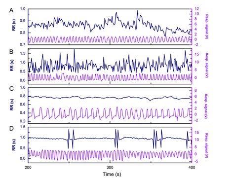 Examples Of Rr Interval Time Series And Respiratory Signal In A One