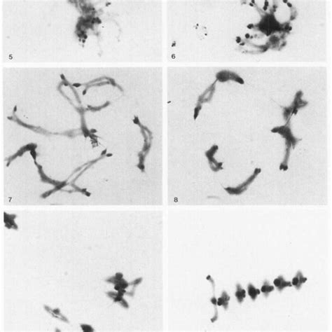 Meiotic Stages Stained With C Banding Method Fig 5 Second Download Scientific Diagram