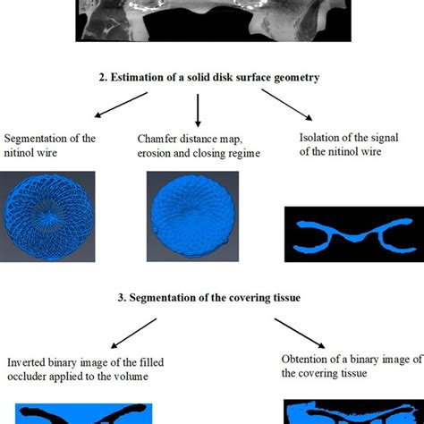 Pipeline Of The 3d Reconstruction Download Scientific Diagram