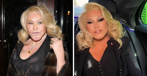 Jocelyn Wildenstein Mocked As She Denies Having Plastic Surgery Despite