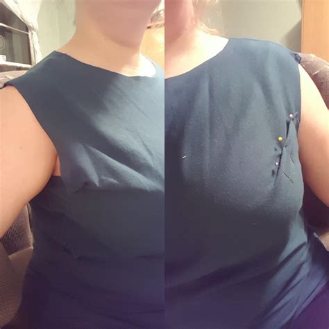 887 Best Armpit Images On Pholder Dermatology Pics And Aww