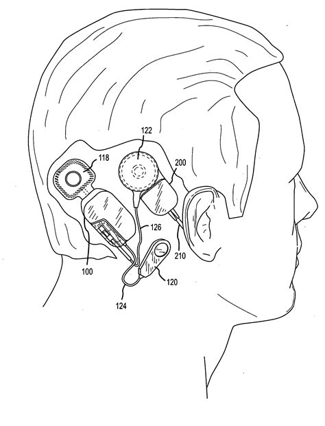 Behind The Ear Hearing Aids Patented Technology Retrieval Search Results Eureka Patsnap