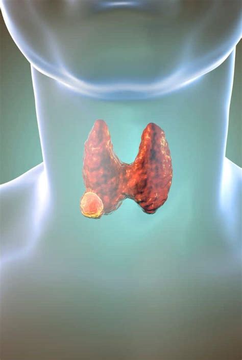 Icd 10 Dysphagia Grants For Medical