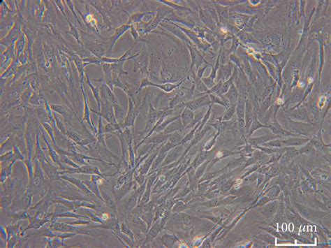 Osteoblast Morphology Of A C And E The Control Group And B D And