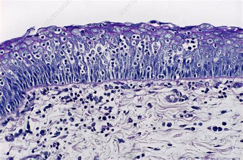 Squamous Epithelium Lm Stock Image C0222225 Science Photo Library