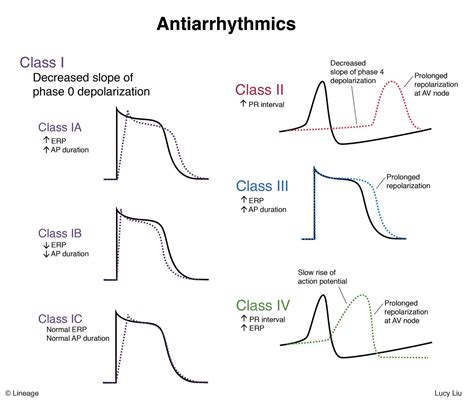 Antiarrhythmics Usmle Strike