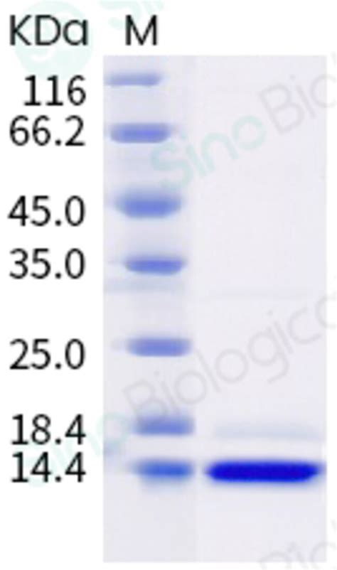 Sino Biological Sars Cov 2 2019 Ncov Nucleocapsid Ctd Protein His