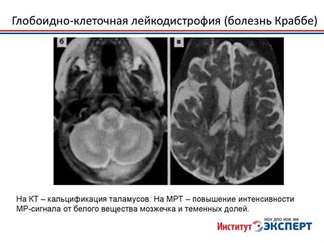 Возможности МРТ в диагностике органических изменений головного мозга