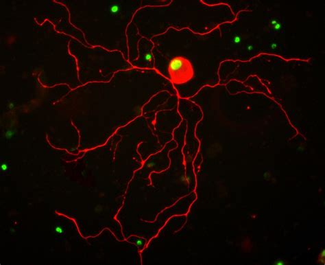 Rat Neonatal Dorsal Root Ganglion Drg Neurons Lonza 54 Off
