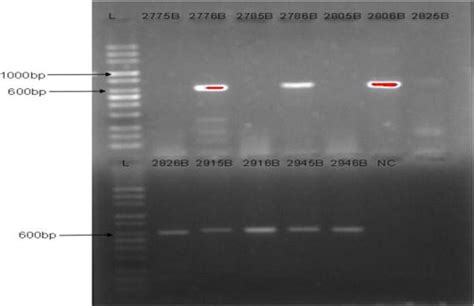 Prevalence And Risk Factors For Genital Human Papillomavirus Infections Among Women In Southwest