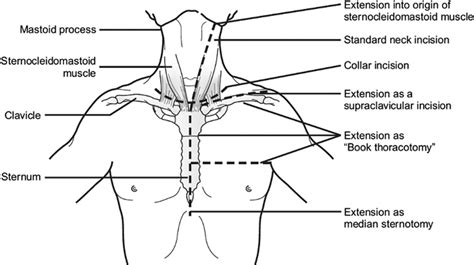 Neck Trauma