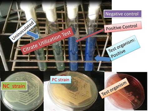 Citrate Utilization Test Principle Procedure Result And