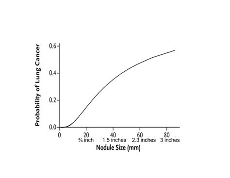 Pulmonary Nodule Size Matters — Lung Cancer Kilts Research Cures