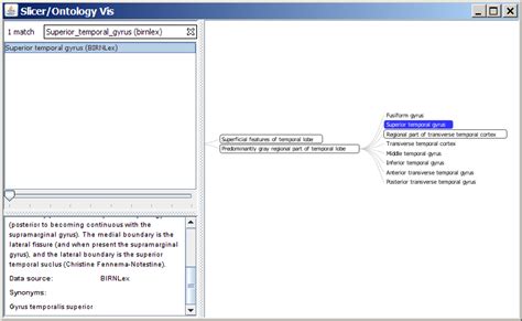 Modules QueryAtlas Documentation Slicer Wiki