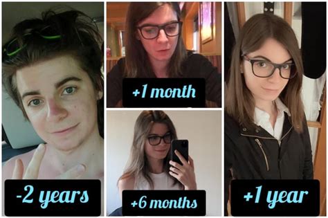 1 Year On Estrogen 😁 So This Is What It Feels Like To Love Yourself R Transtimelines