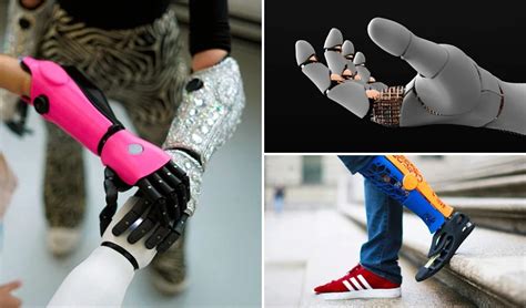 3d Printing Prosthetics Is Revolutionizing The Future