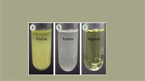 Exp 9 Prepare Iodoform From Ethanol Youtube