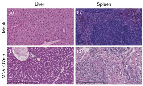 Liver And Spleen Pathology In Stat1 −− Mice Infected With Mnv O7mc