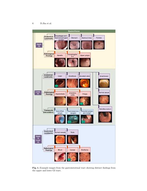 Gastrovision A Multi Class Endoscopy Image Dataset For Computer Aided Gastrointestinal Disease
