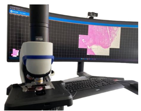 Hsa Scan Hs Analysis Gmbh