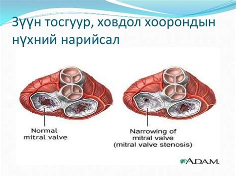 Lecture 11