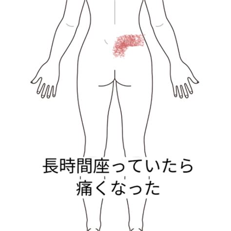 座位や前屈で生じる腰の痛み｜腰痛のツボ｜ツボネット 鍼灸の症例が検索できるツボ辞典