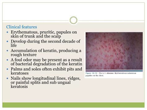 Genodermatoses Pptx Skin And Dermatology Diseases And Conditions