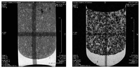 Magnetic Relaxation Switching Assay Using Ifnα 2b Conjugated Superparamagnetic Nanoparticles For